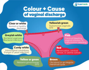 Vaginal Discharge: Types, Causes, Colors, Treatment & Prevention