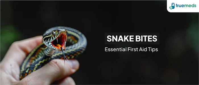 Snake Bite First Aid: Symptoms, Treatment, and Do’s & Don’ts